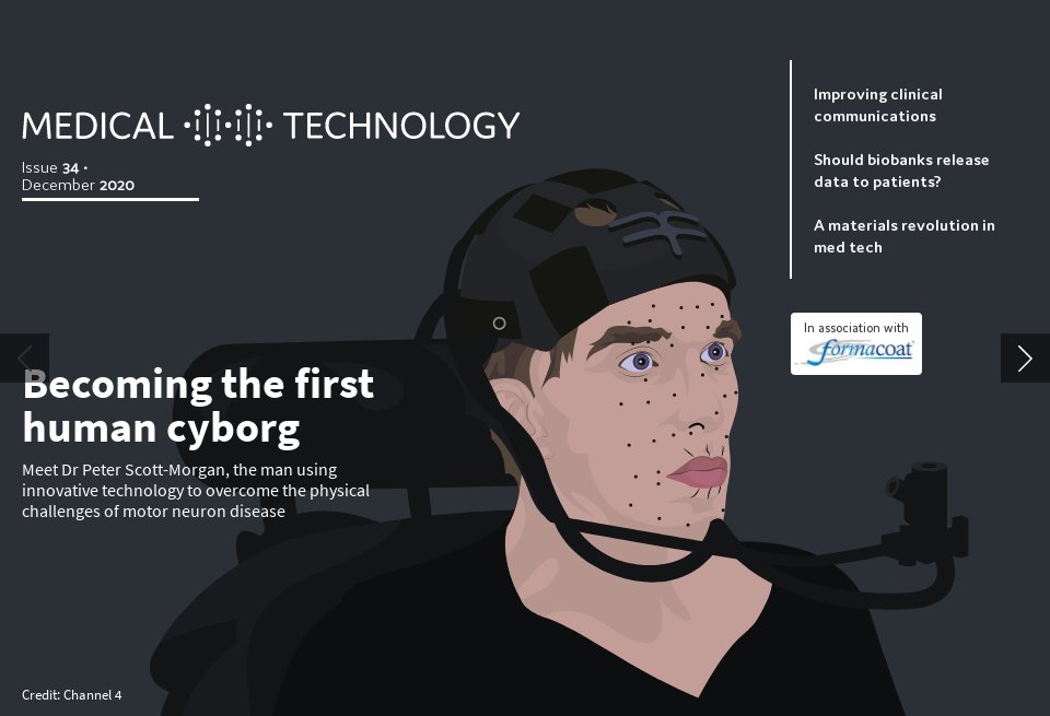 Home | Becoming the first human cyborg - Medical Technology | Issue 34 ...