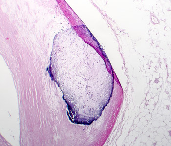 Home | How advancing tech has shaped mental health in 2022 - Medical ...