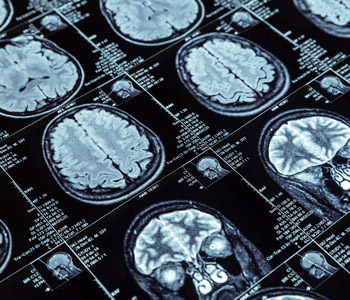 Home | How advancing tech has shaped mental health in 2022 - Medical ...