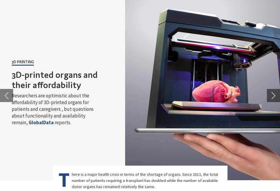 3d printed organs
