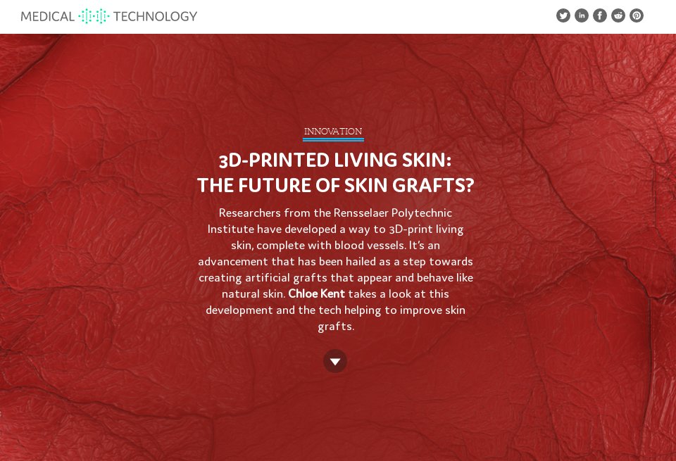 3D-printed living skin: the future of skin grafts? - Medical Technology ...