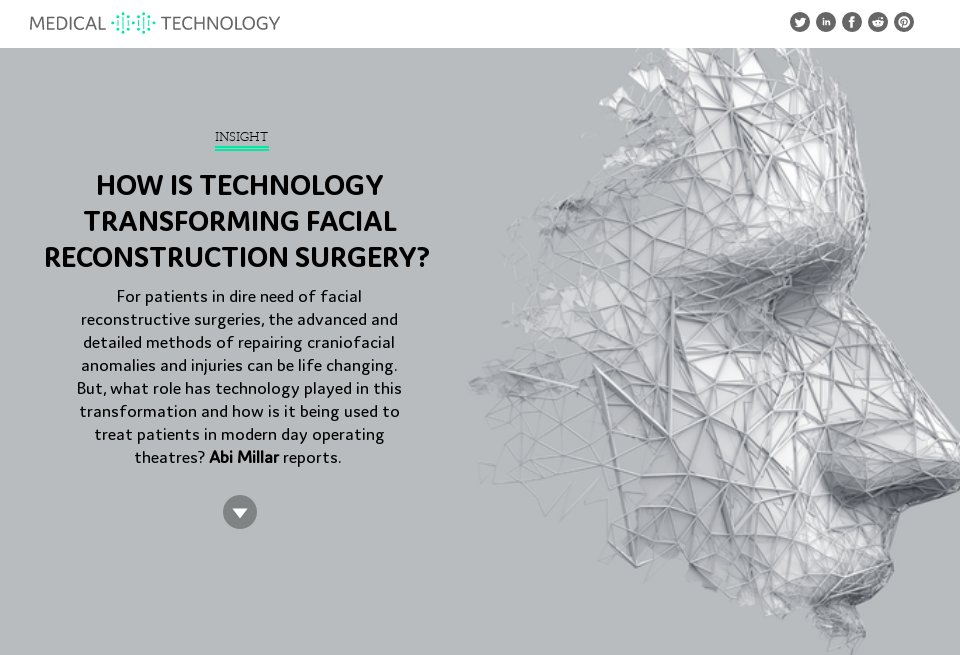 How is technology transforming facial reconstruction surgery? - Medical ...