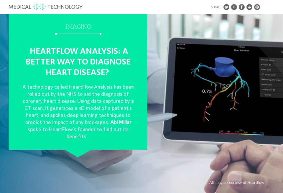 HeartFlow Analysis: a better way to diagnose heart disease? - Medical ...
